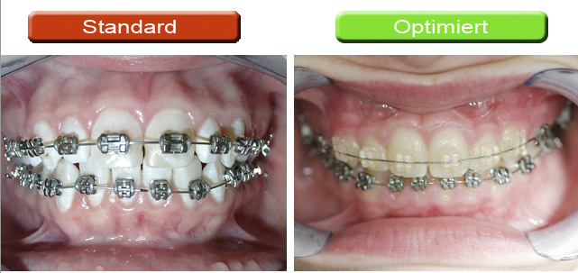 Zusatzleistungen | Praxis Dr. Blens